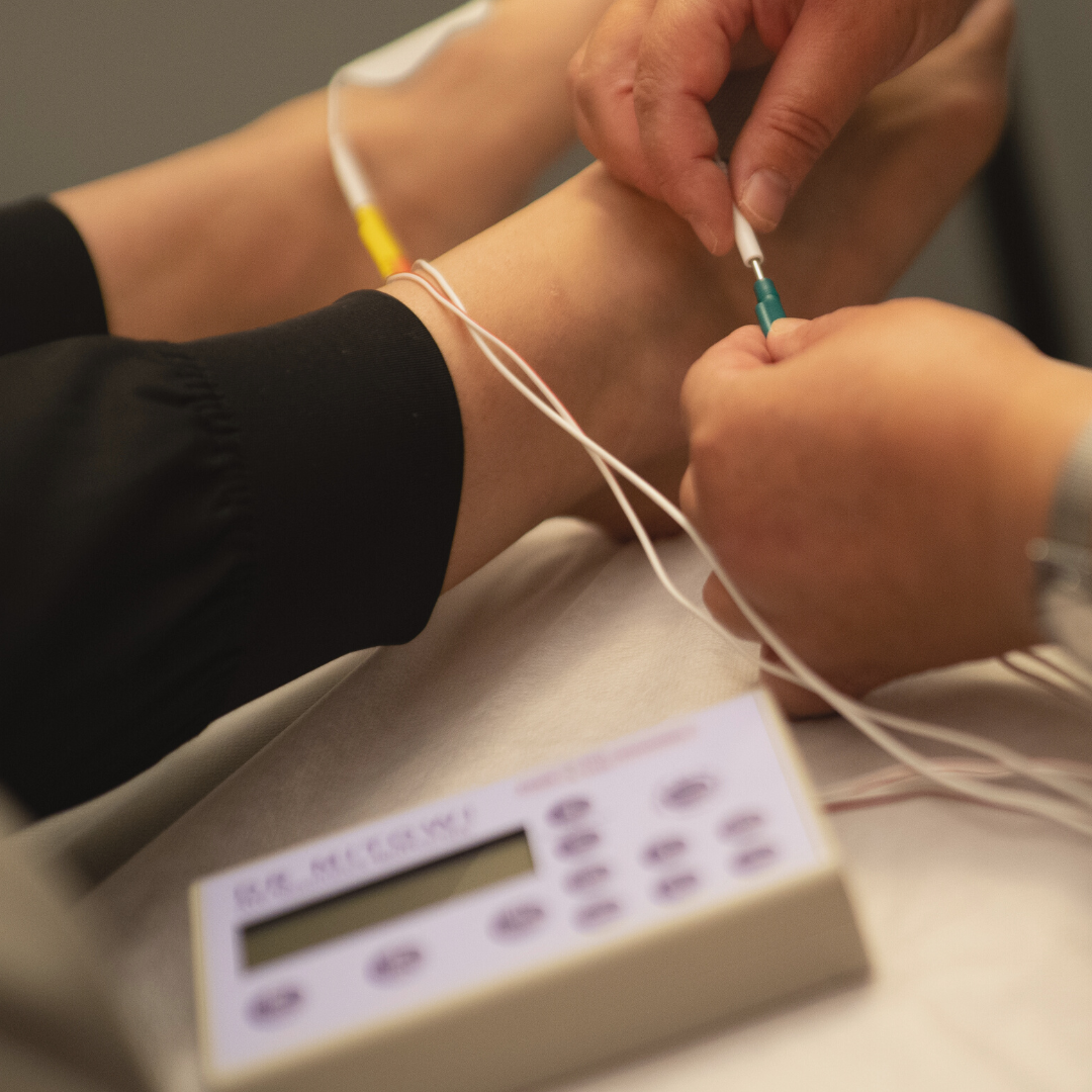 Microcurrent Therapy in Columbia, MO - Columbia Integrative